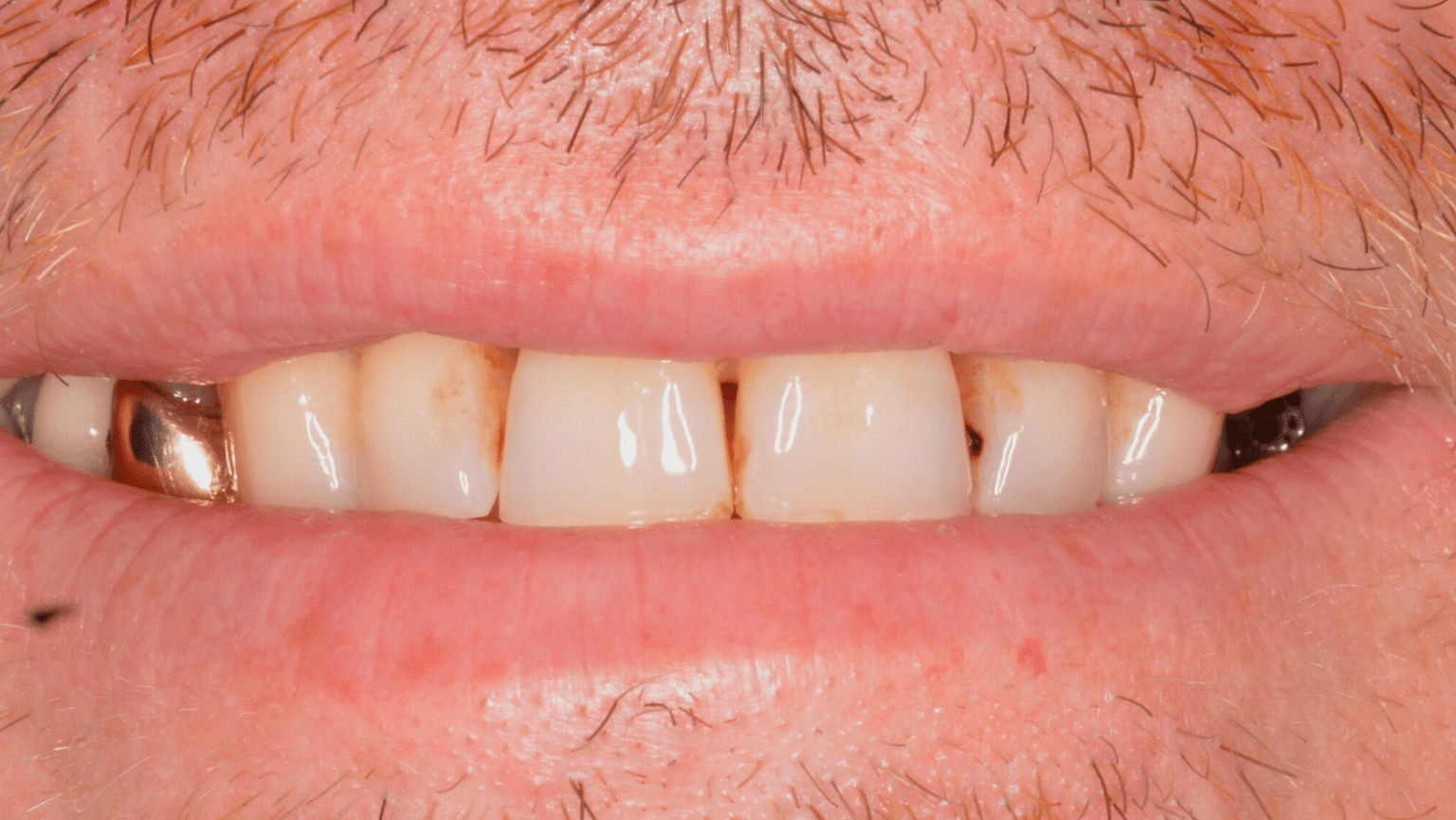 website (19) | Church Street Dentist Bilston