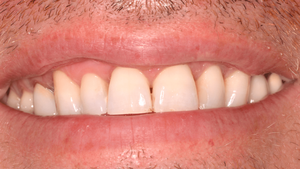 website (20) | Church Street Dentist Bilston